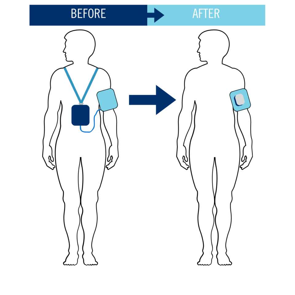 Simplifying System Architecture for Ambulatory Blood Pressure ...